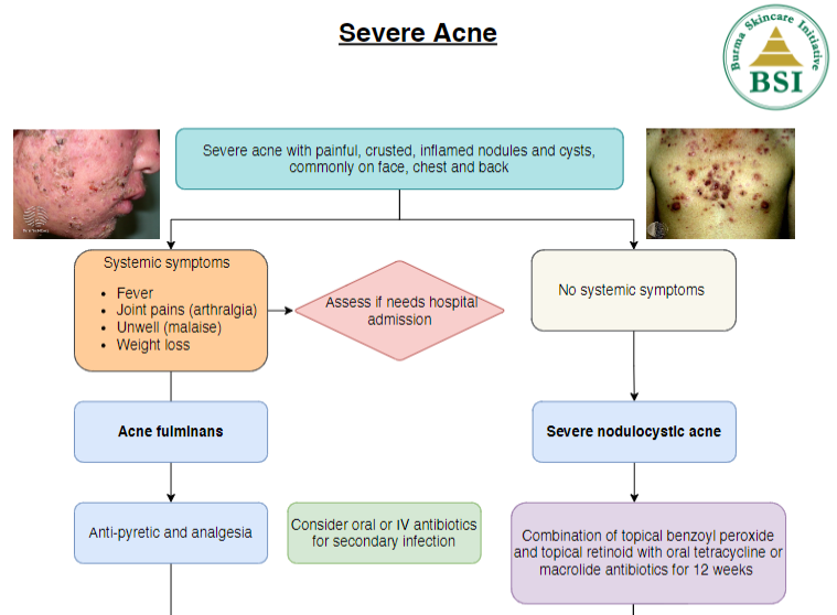 Severe Acne - Burma Skincare Initiative